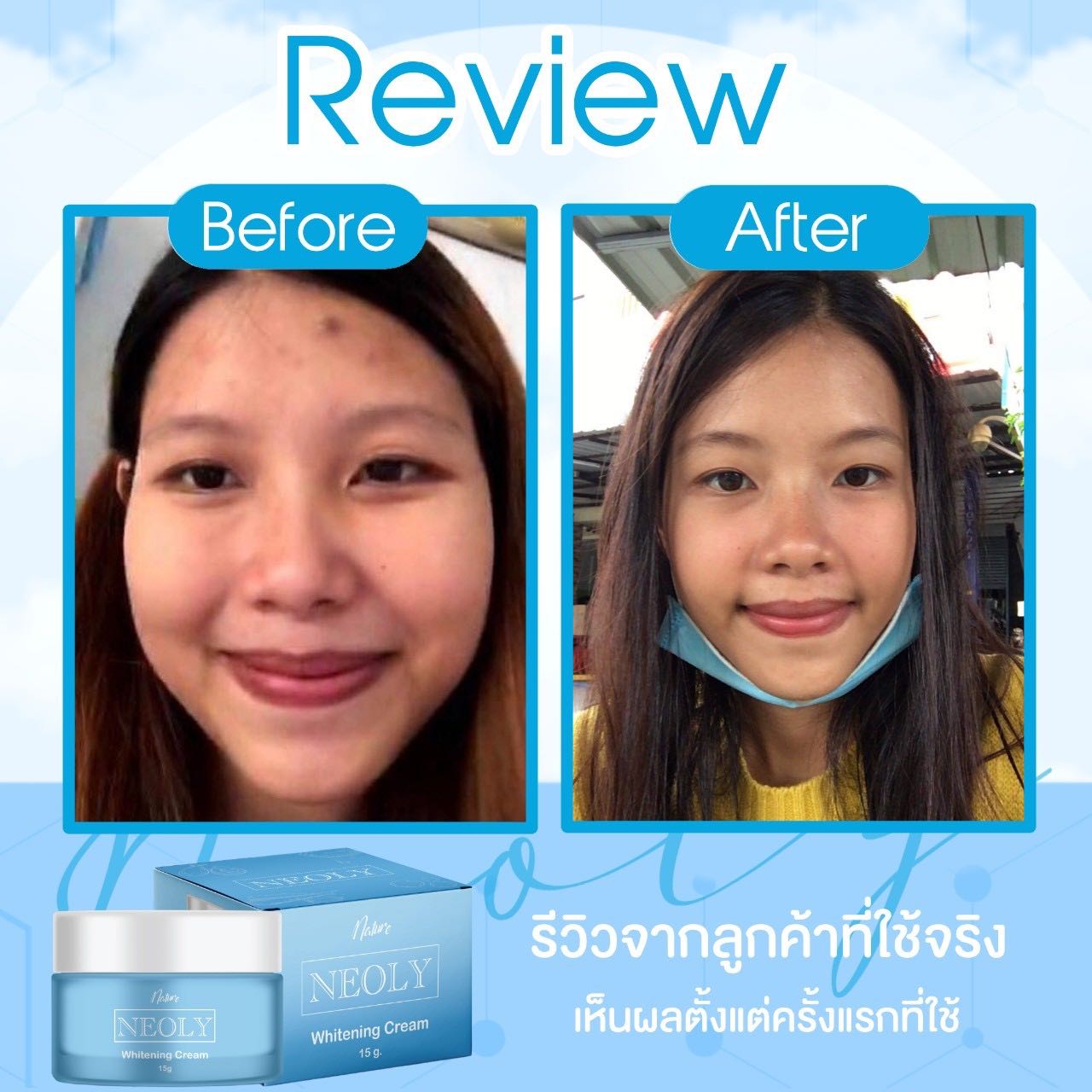 Neoly นีออลี่ | LINE SHOPPING