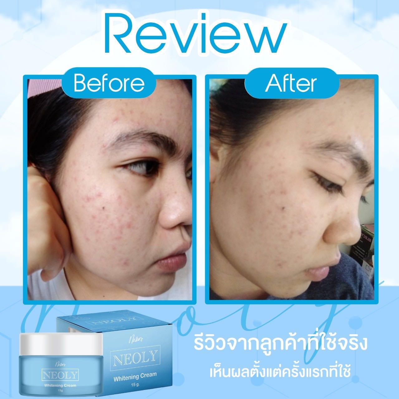 Neoly นีออลี่ | LINE SHOPPING