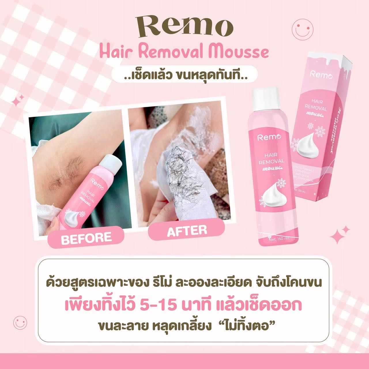 Remo Hair Removal mousse รีโม่ มูสกำจัดขน มูสขจัดขน มูสกำจัดขนถาวร สเปรย์กำจัดขน กำจัดขนขา ขน ...