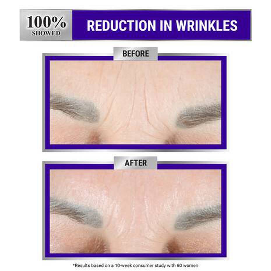 Kiehl's Retinol Fast Release Wrinkle-Reducing Night Serum 28 ml | LINE ...