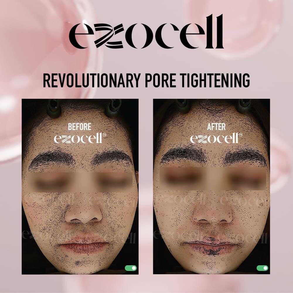 Exocell Exosome Rejuvenation Ampoule | LINE SHOPPING