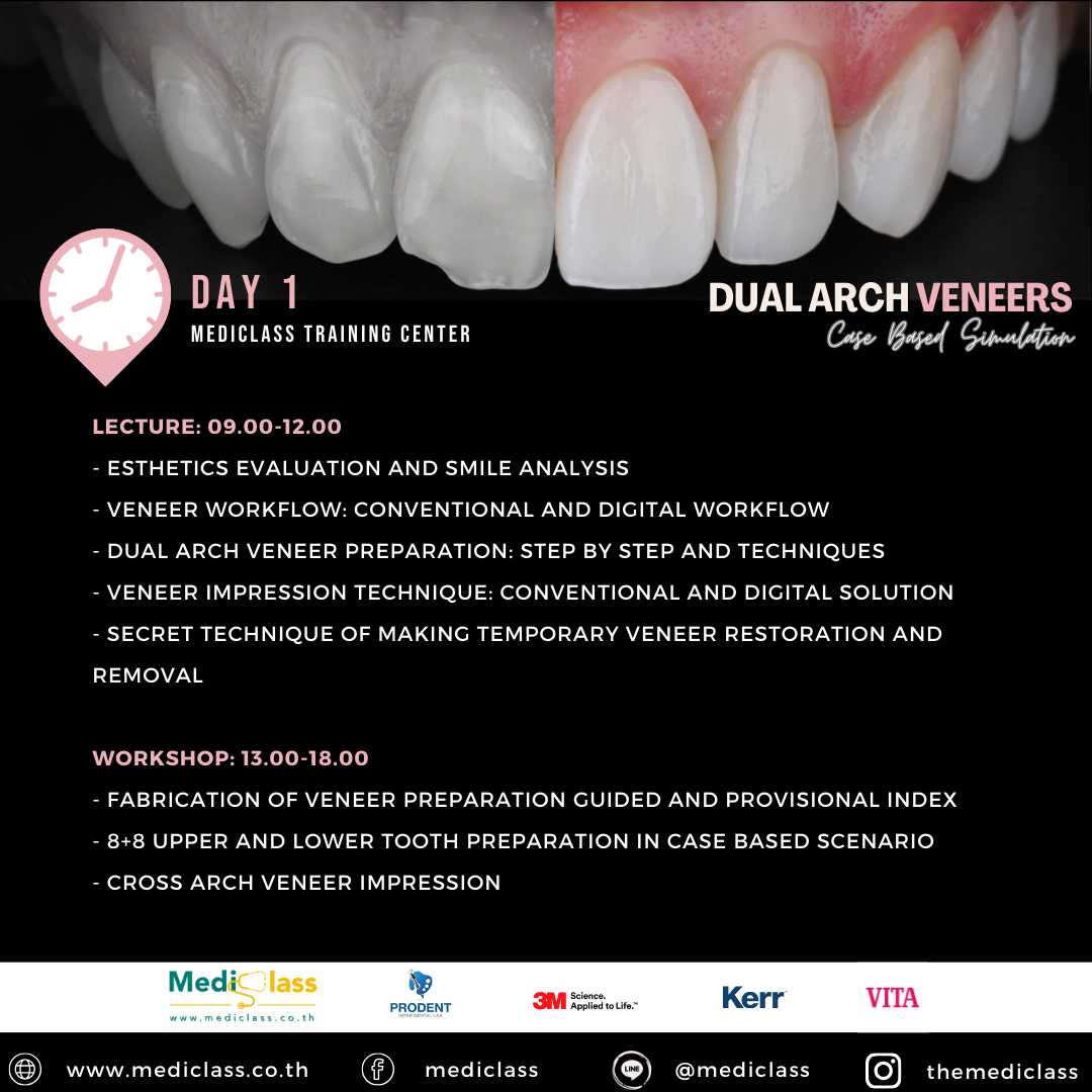 Dual Arch Veneers Gen 3 | LINE SHOPPING