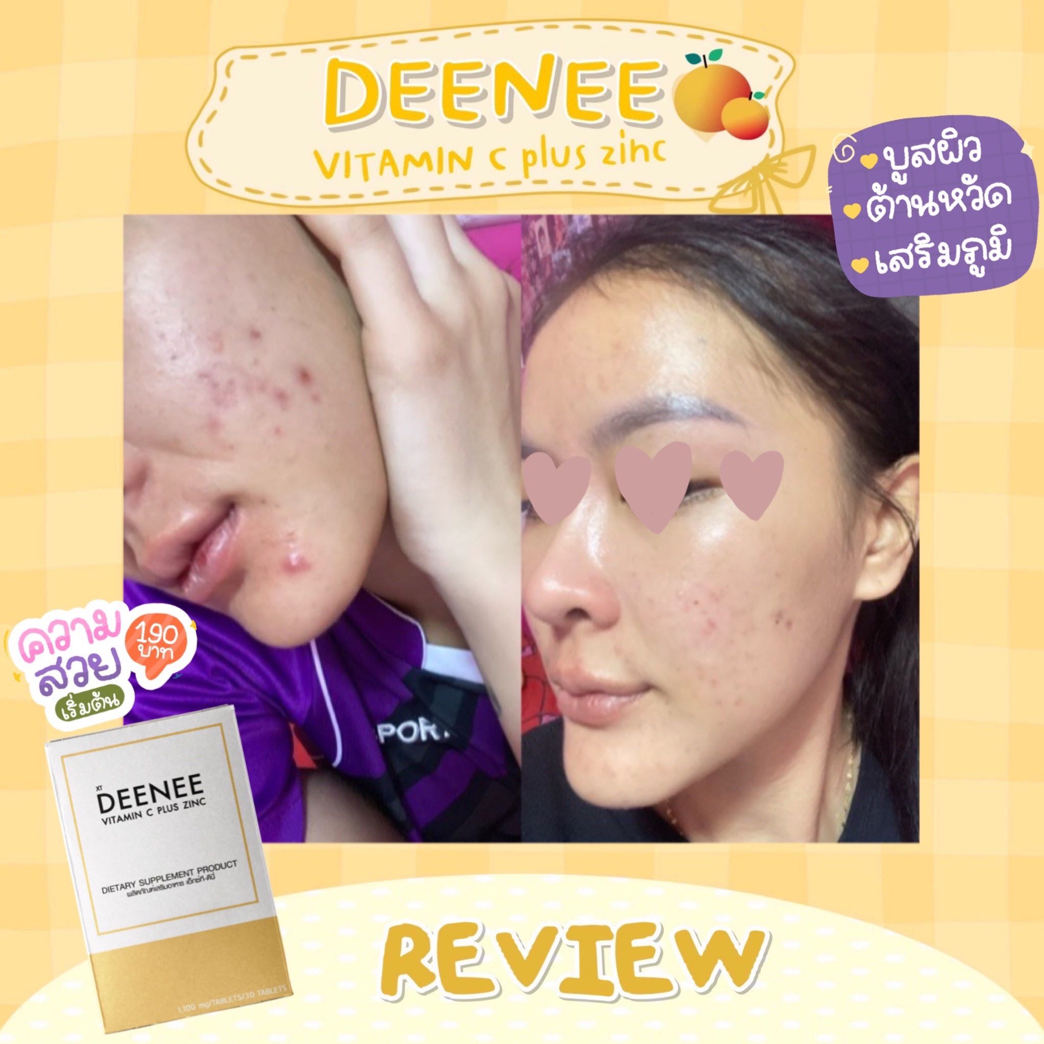 Deenee ดีนี่วิตามินซี ผิวสวย | LINE SHOPPING